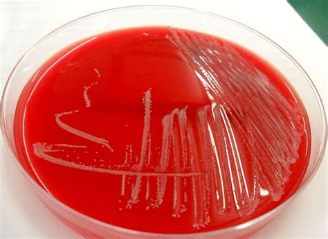 Bacterias Gram Positivas Características Estructura Enfermedades 2022