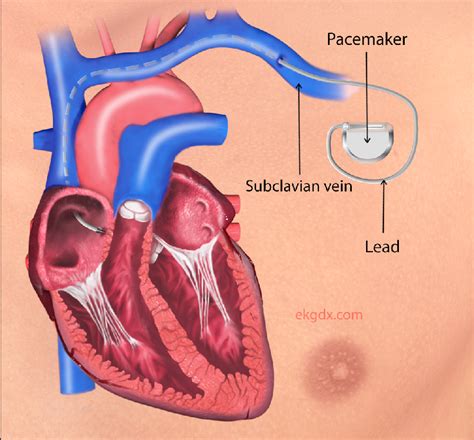 Ekgdx The New Era Of Ekg Learning