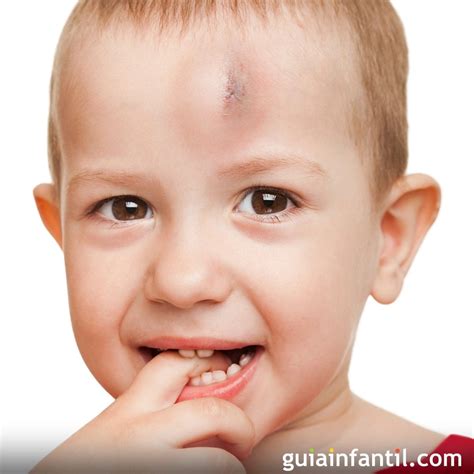 Cuando Un Niño Se Golpea La Cabeza Que Hacer Niños Relacionados