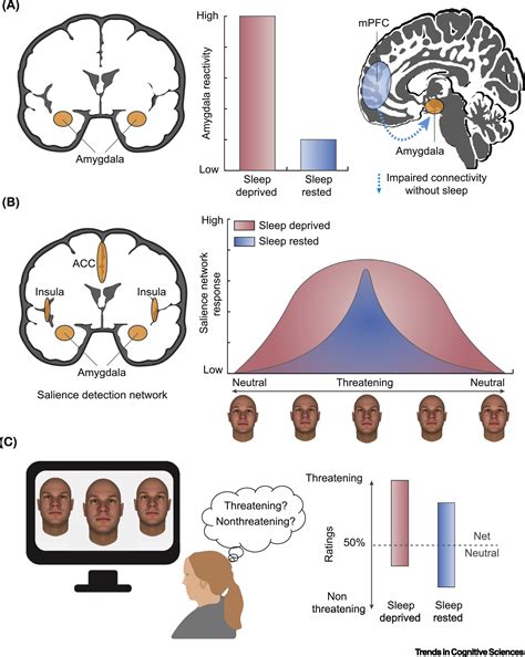 Sleep Deprivation Effects On The Brain