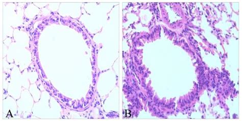 Eosin Staining Of The Lung Tissue Slices In Mice A Control Mice At