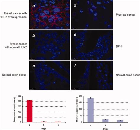 Representative Figures And Image Quantitation From Tissue Microarray