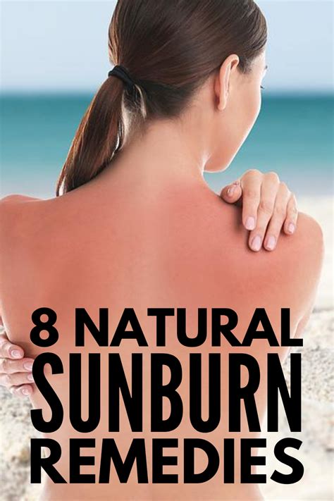 Too Much Sun 8 Natural Sunburn Remedies That Work Fast