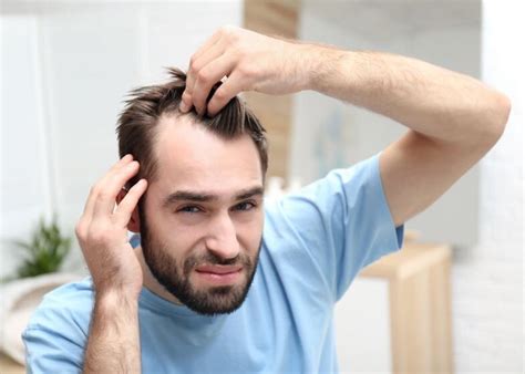 The Best Hair Loss Treatments For Men