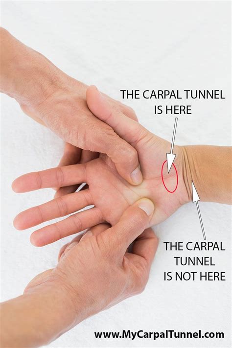 Pin On How To Apply Carpal Solution