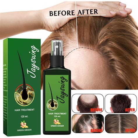 120ml Jaysuing Green Ginger Hair Growth Spray Serum Natural Anti Hair