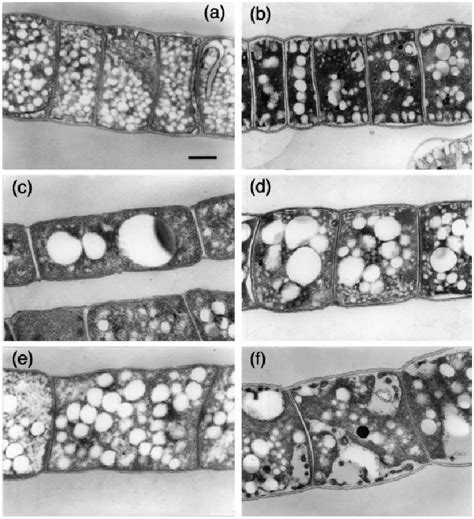 Transmission Electron Micrographs Of Ultrathin Sections Of Cells Of
