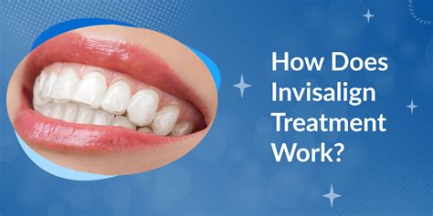How Does Invisalign Treatment Work La Dental Clinic