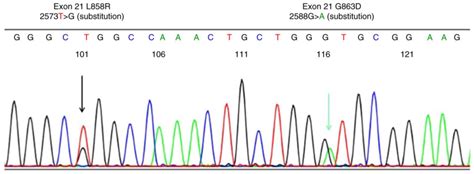 Investigation Of Egfr Mutations In Non‑small Cell Lung Cancer Usually
