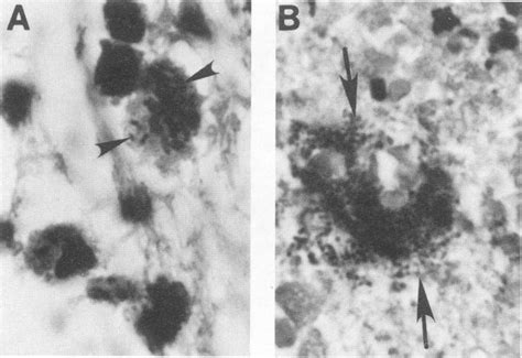 A Large Numbers Of Intracellular Bacteria Arrowheads And B