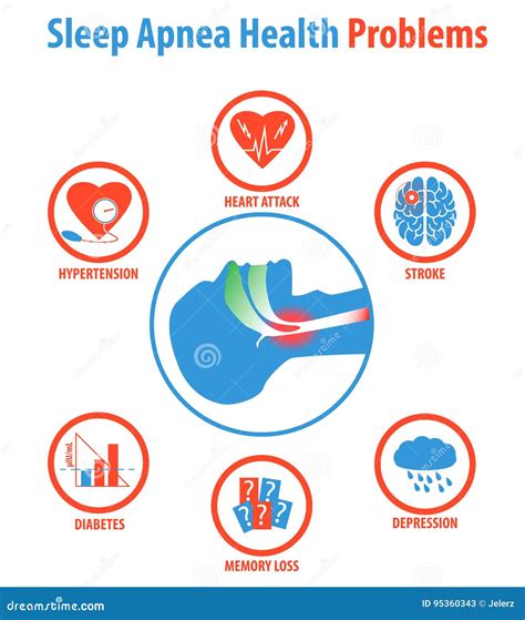 Sleep Apnea Treatments Causes Symptoms And Health Problems Stock