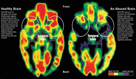 Early Attachment Relationships And Their Impact On The Brains Wiring