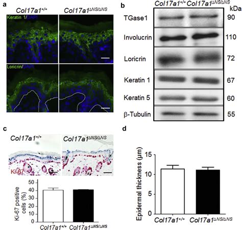 Normal Epidermal Differentiation In The Skin Of Col17a1 Dns Dns Mice