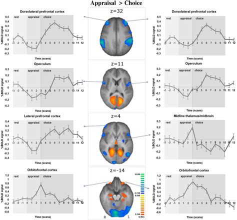 The Role Of Prefrontal Cortex In A Battle Of The Sexes Dilemma