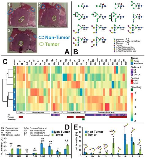 Unlocking Cancer Glycomes From Histopathological Formalin Fixed And