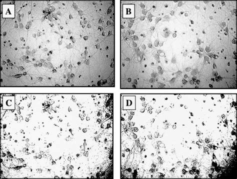 Effect Of Hypoxic Preconditioning On Expression Of Tnf Type 1 Receptor