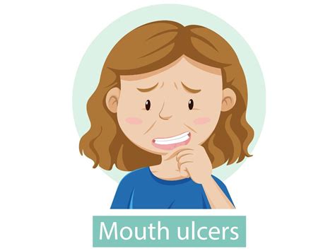Understanding Aphthous Ulcers Causes Symptoms And Treatment
