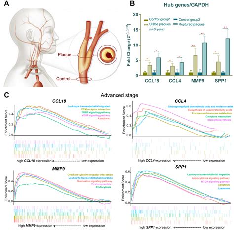 Identification And Validation Of Four Hub Genes Involved In The Plaque