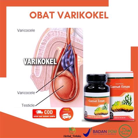 Jual Obat Varikokel Herbal Benjolan Pada Testis Buah Zakar Bengkak