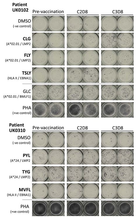 Mva El Stimulates Ebna1 And Lmp2 Epitope Specific T Cell Responses
