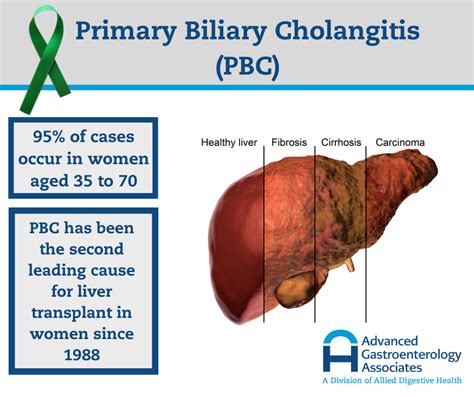 Primary Biliary Cholangitis What It Is Symptoms 45 Off