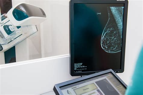 Everything You Need To Know About Screening Mammograms Blog