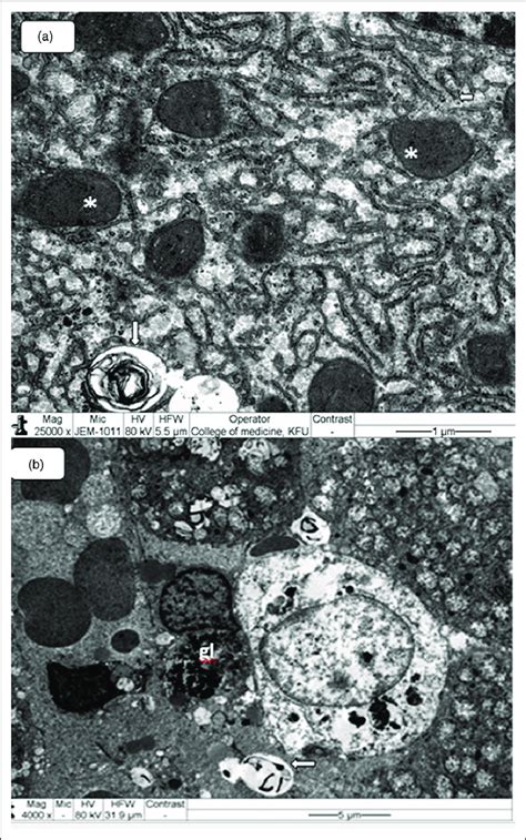 A B Transmission Electron Micrographs Of Ultrathin Sections In
