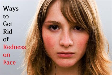 How To Get Rid Of Redness On Face