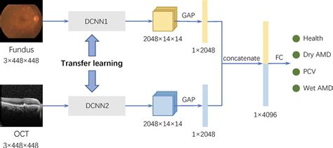 automated diagnoses of age related macular degeneration and polypoidal
