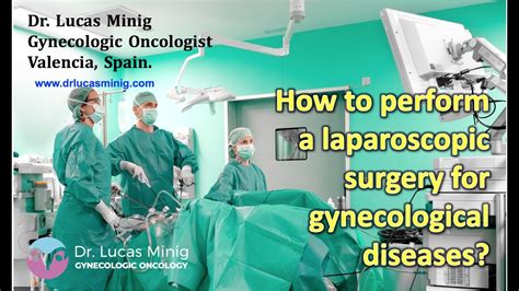 🔷 Laparoscopic Surgery For Gynecological Diseases Dr Lucas Minig
