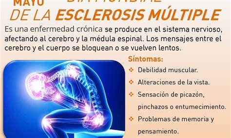 Esclerosis MÚltiple ¿qué Es Y Cómo Se Trata