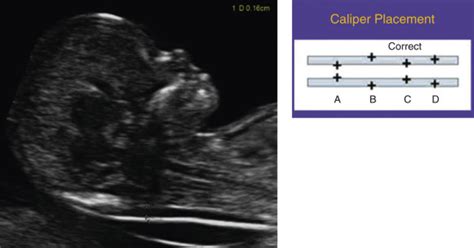 Obstetric Ultrasound Examination Radiology Key