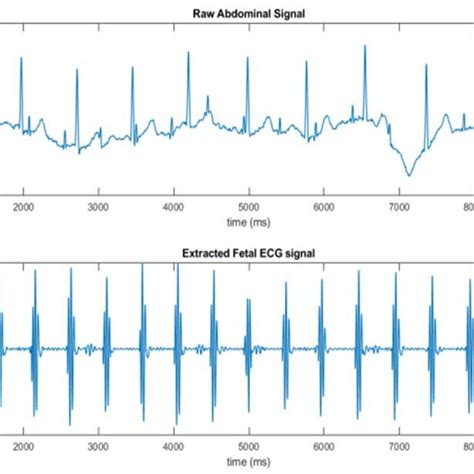Representing The Raw Abdominal Signal And The Finally Obtained Fetal Ecg