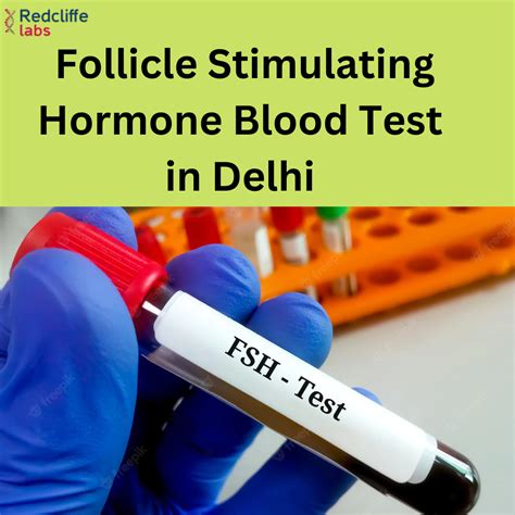 Follicle Stimulating Hormone Fsh Test In Delhi — Redcliffe Labs Red