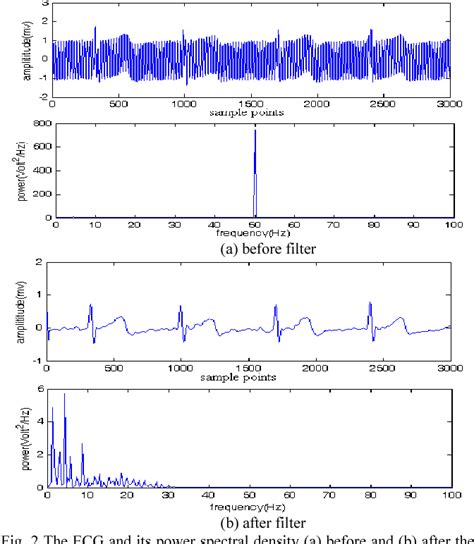 Figure 1 From Comparison Of Median Filter And Discrete Dyadic Wavelet