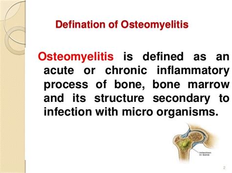 Acute And Chronic Osteomyelitis Infection Of Bone