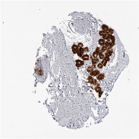 Tissue Expression Of Timp1 Staining In Bronchus The Human Protein Atlas