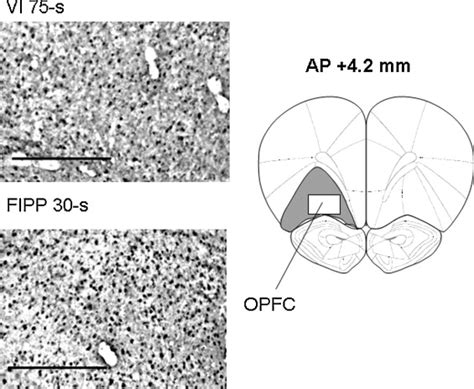 Left Hand Panels Examples Of Fos Expression In The Orbital Prefrontal