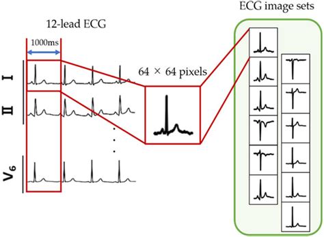 Bioengineering Free Full Text End To End Convolutional Neural