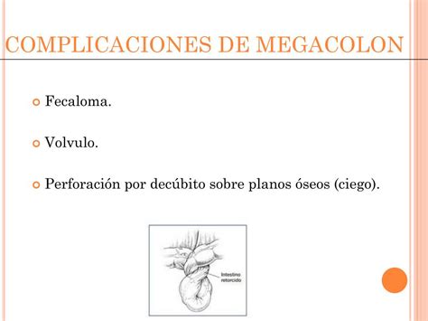 Ppt Megacolon Powerpoint Presentation Free Download Id 1997516
