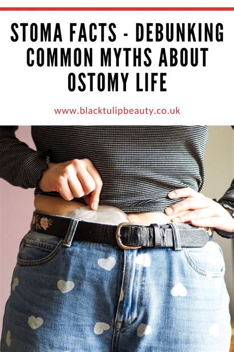 Stoma Facts Debunking Common Myths About Ostomy Life Ostomy Fashion