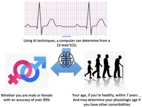 age and sex estimation using artificial intelligence from standard 12