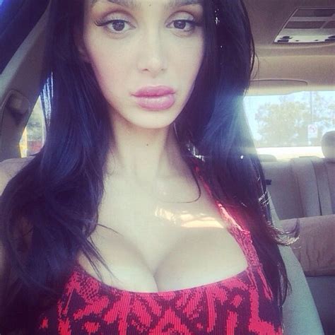 Amy Anderssen