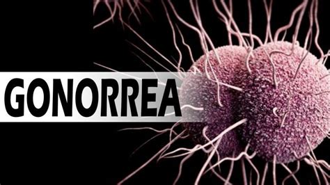 ¿qué Es La Gonorrea Causas Síntomas Prevención Tipos Diagnóstico Y