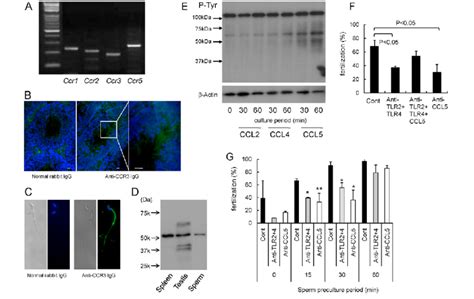 Sperm Express Chemokine Receptors Required For Sperm Capacitation
