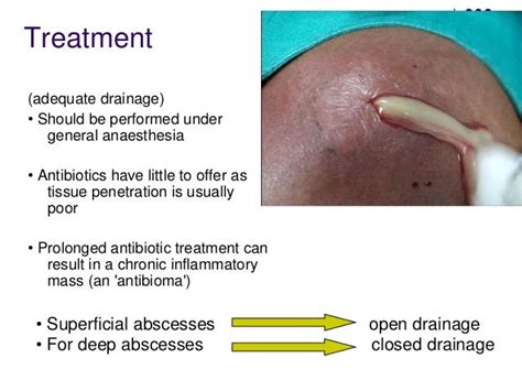 Surgery Surgical Infections 1 2