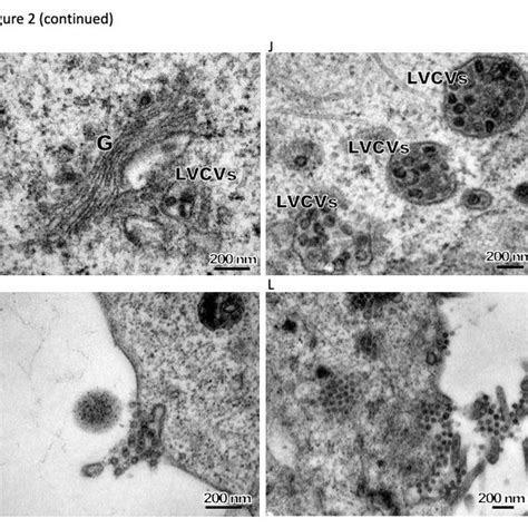 Electron Microscopy Em Observation Of In Vitro Pdcov Infection