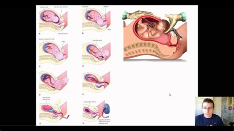 factos of successful pregancies and human reproduction
