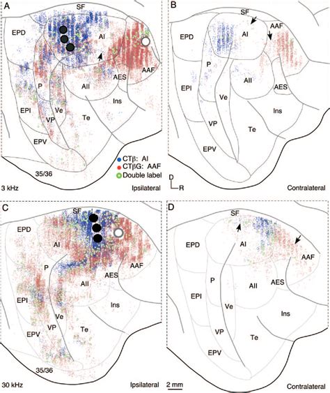 Figure 2 From Concurrent Tonotopic Processing Streams In Auditory