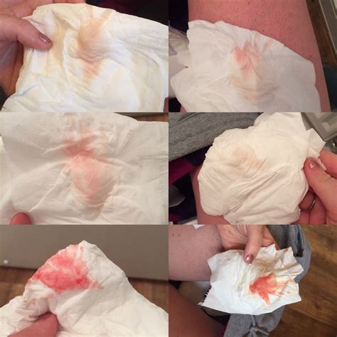 Implantation Bleeding Color Chart